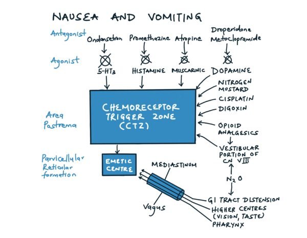 Post-operative Nausea and Vomiting (PONV) - Hyperexcision