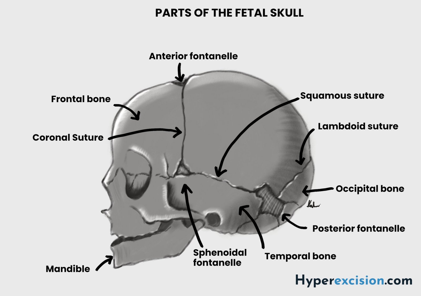 Pelvic Assessment and Cephalopelvic Disproportion (CPD) - Hyperexcision